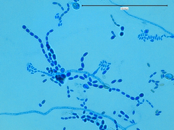 Fun With Microbiology (What's Buggin' You?): Arthrographis species