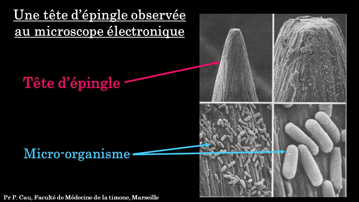 Le labo d'Anissa - SVT: Chapitre 1 : La contamination par les micro ...