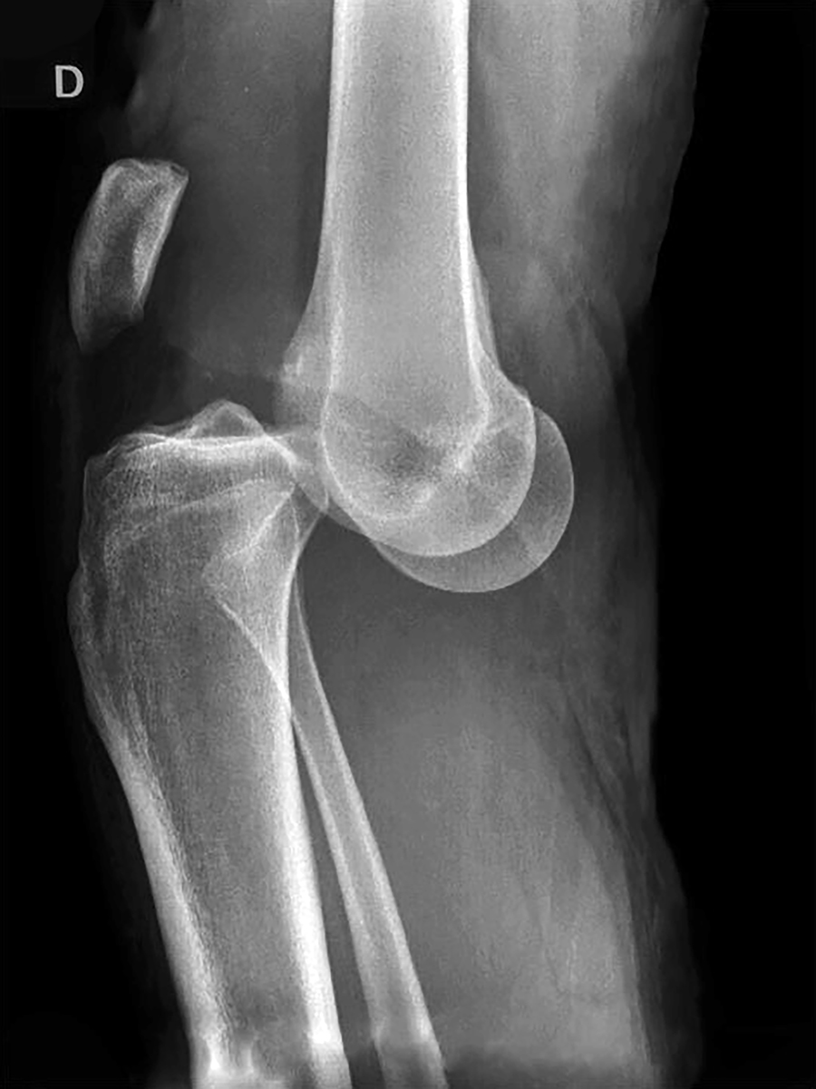 Lesiones musculoesqueléticas