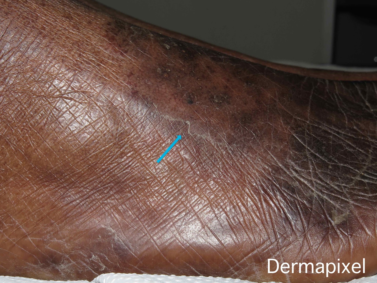 Dermapixel: agosto 2019