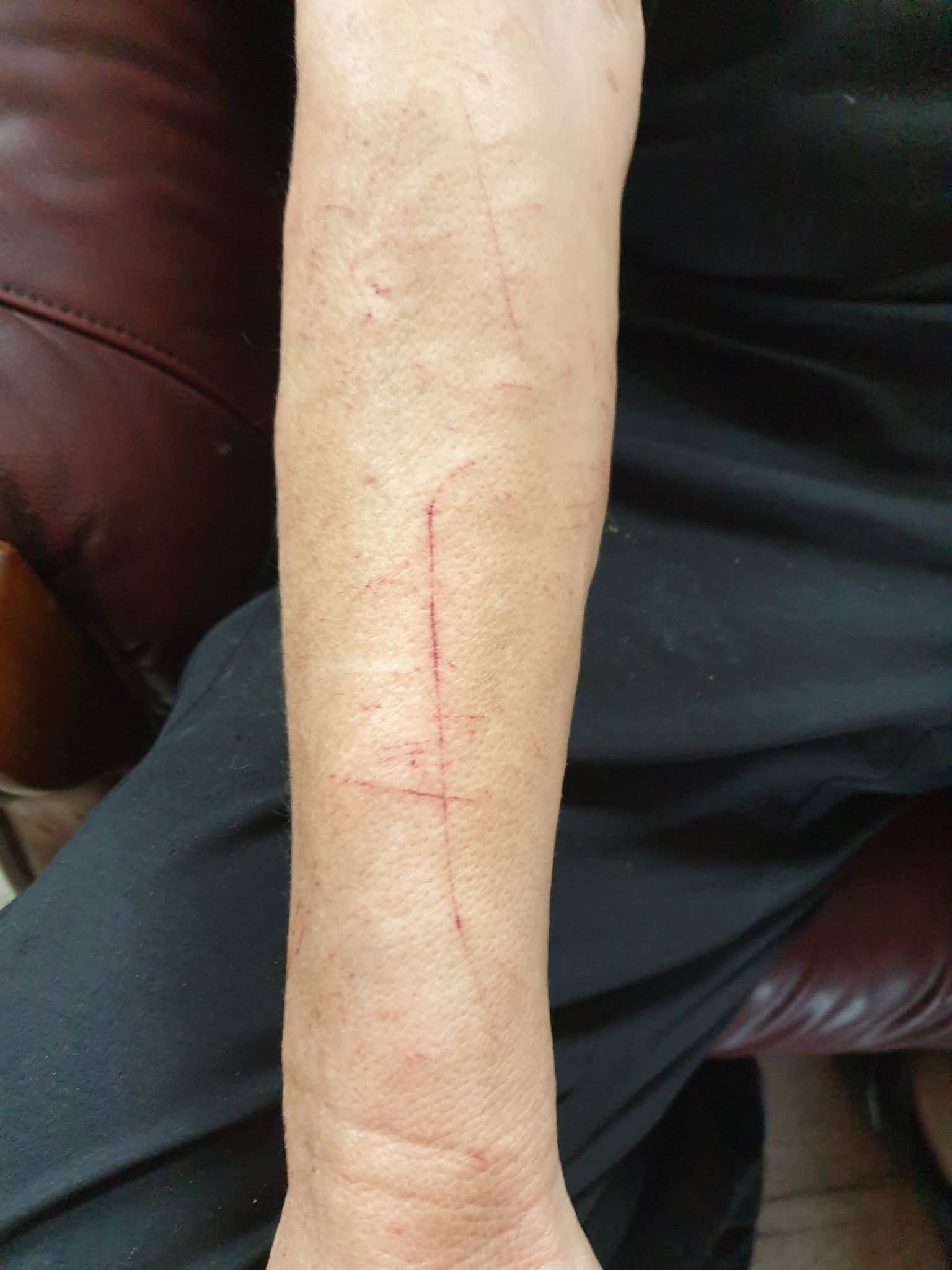 NORTHSIDER : Bramble Scars.