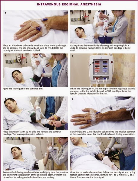 Procedures Club: The Bier Block