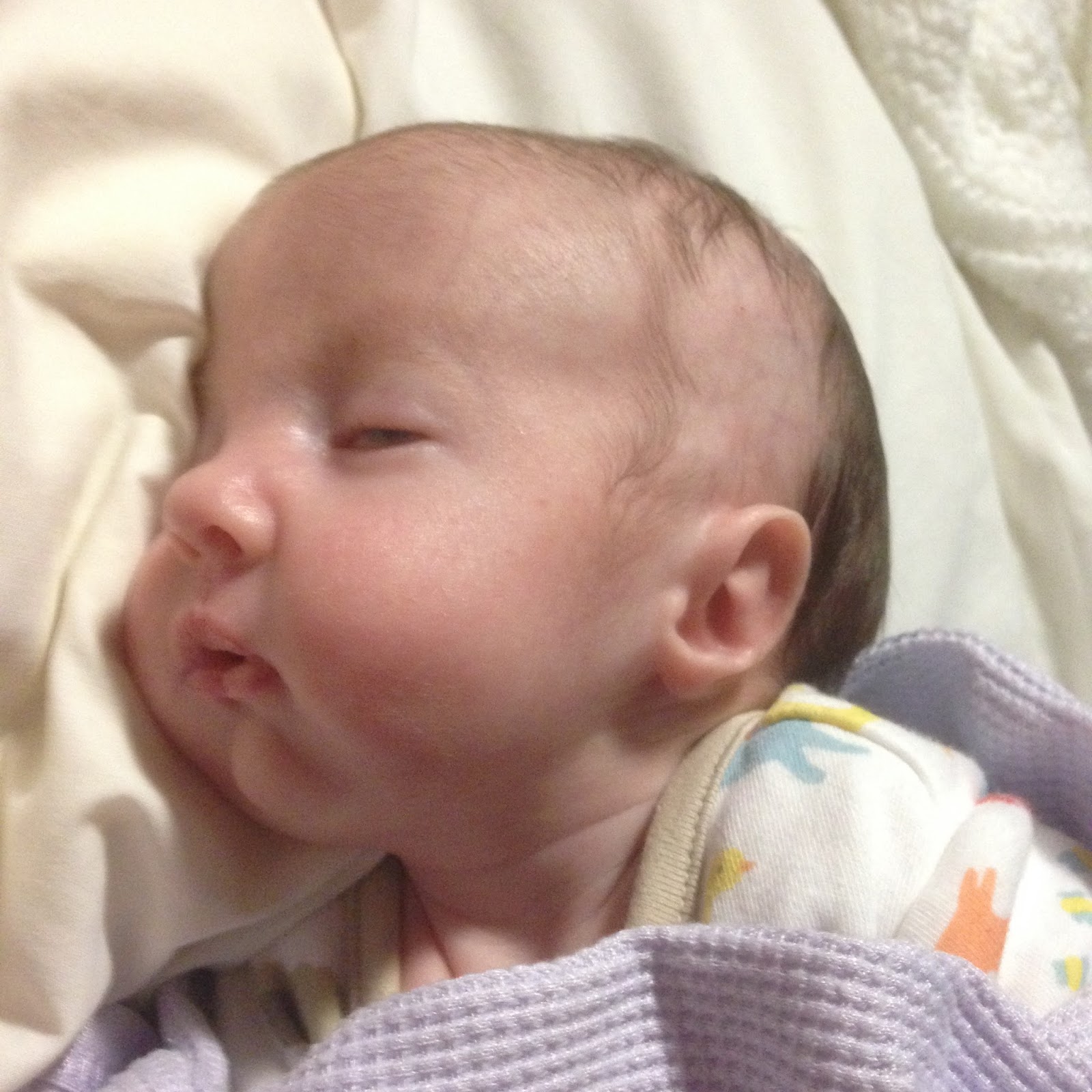 What Is Trisomy 18 Rumer s Rainbow
