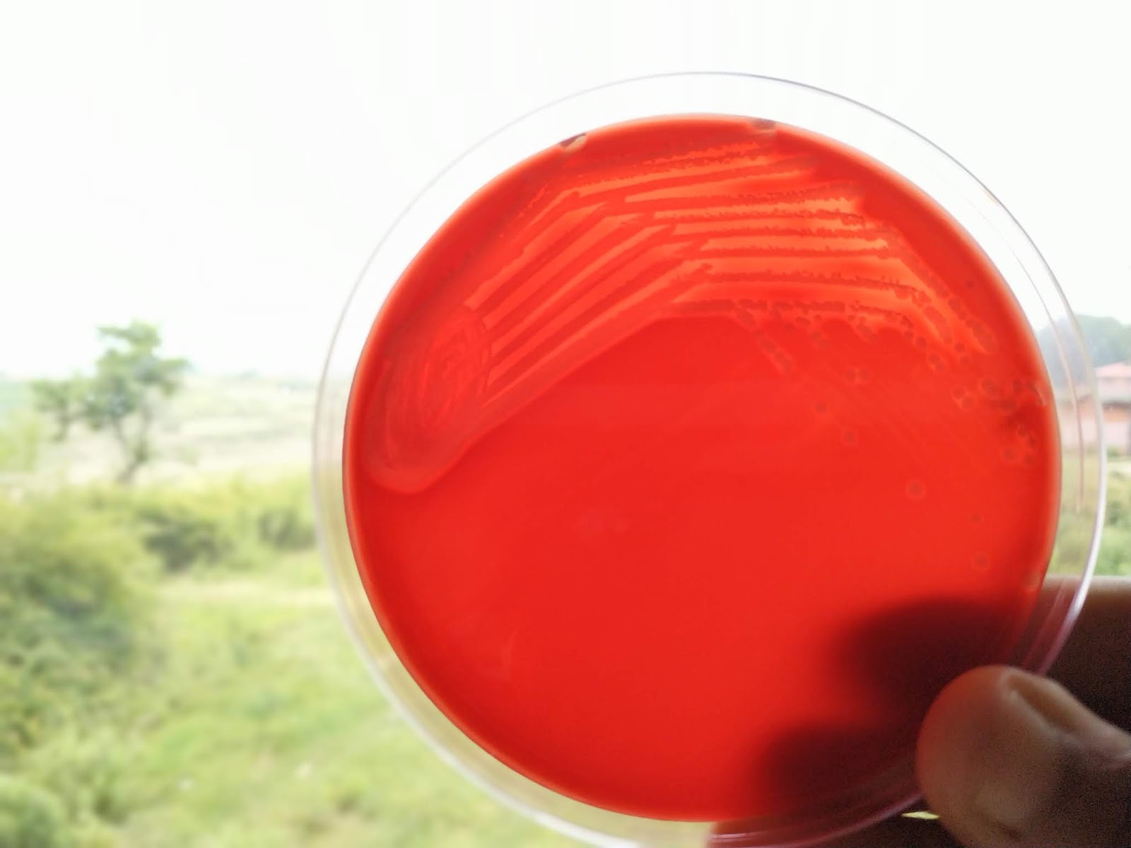 MICROBIOLOGY BLOG FOR STUDENTS (MBLOGSTU): Cultural and Biochemical ...