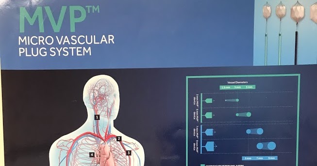 Pedi cardiology: MVP sizing chart