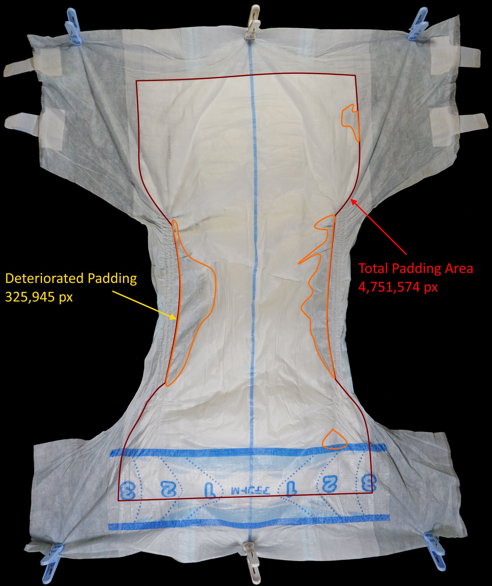 Diaper Metrics: Attento Tape-Style Adult Diaper Review