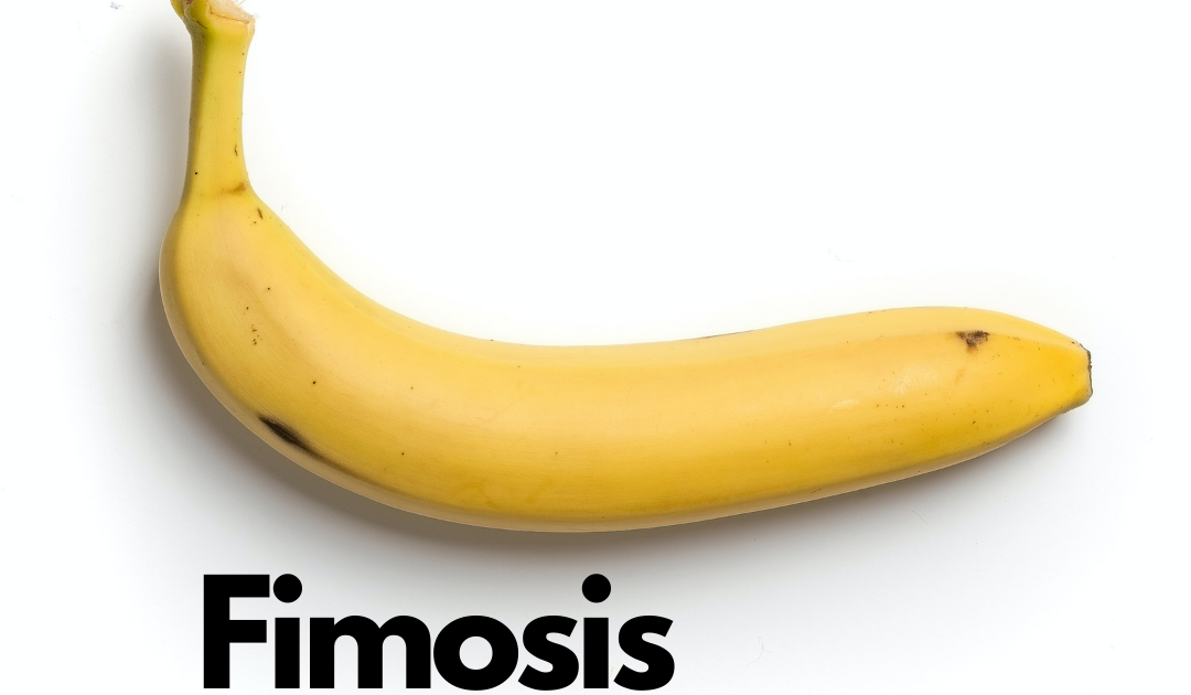 Madrid Urología: Fimosis. Que debes saber.