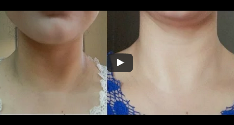 How to Get Rid of Dark Neck in 20 Minutes