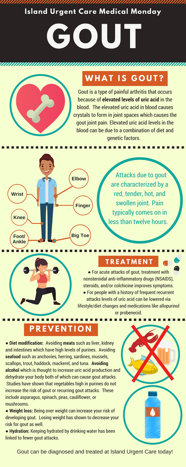 Island Urgent Care Blog: Medical Monday: Gout