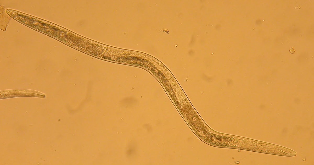 Variety of Life: Diphtherophorina