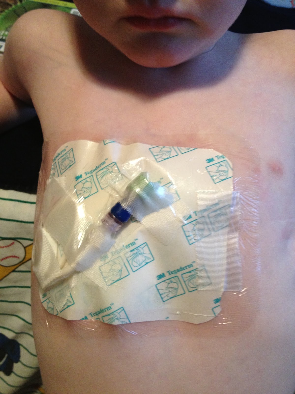 Dream Big, Live Life!: Swimming with a central line