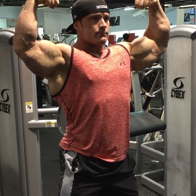 Hola Bodybuilders: IFBB PRO Matthew Schmidt