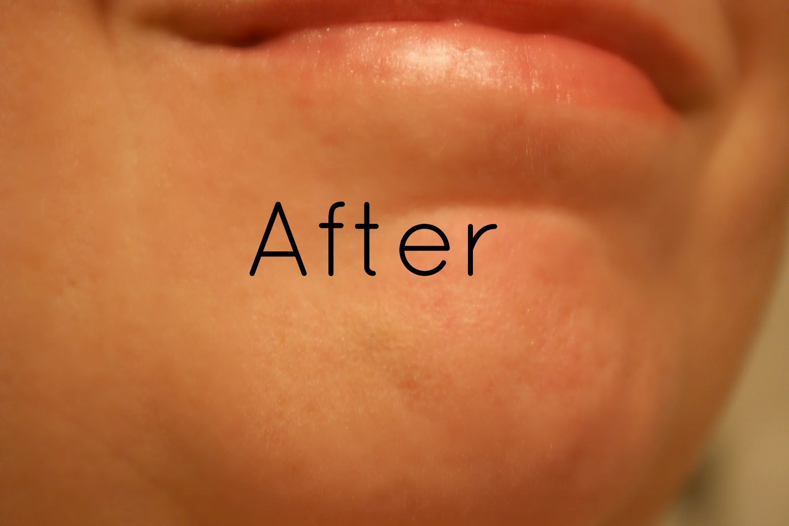 Elle Sees|| Beauty Blogger in Atlanta: How To: Hide a Pimple (Using ...