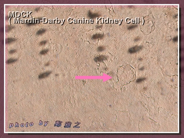 努力不一定會成功, 但成功一定需要努力!: 新手上路看CPE (Cytopathic effect)