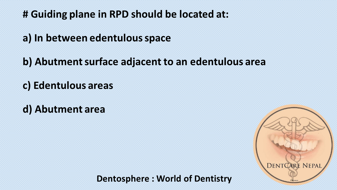 Dentosphere : World of Dentistry: Guiding planes in RPD