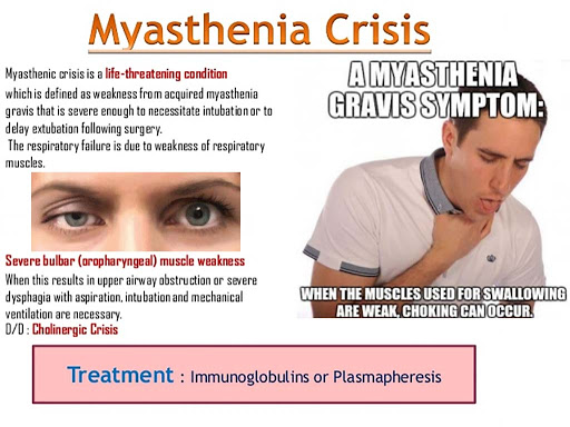 myasthenia gravis,symptoms,diagnosis,treatment