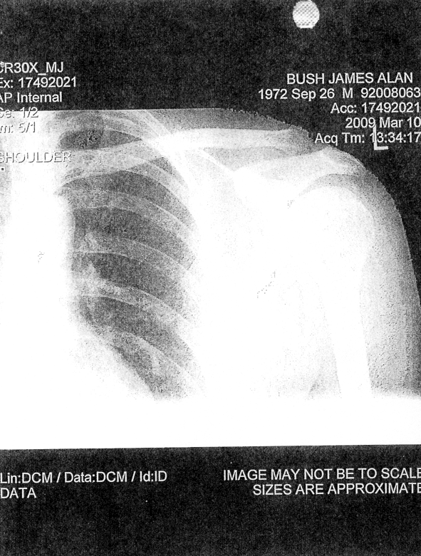 The Life of a Demoniac: Serious injuries mounting fast