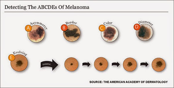 ageless beauty, timeless skin: Melanoma—the deadliest skin cancer