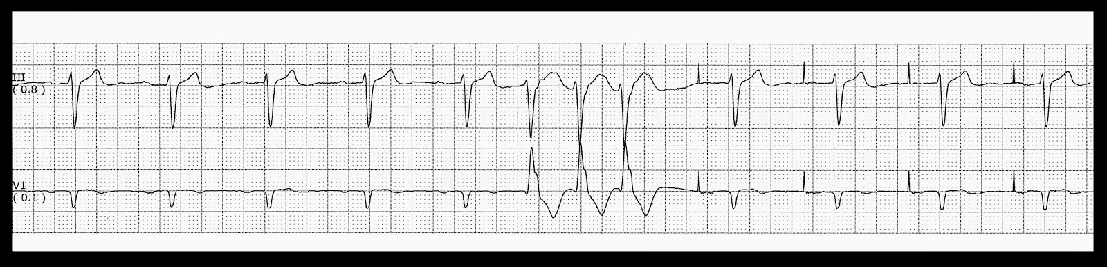 EKG Rhythm Quiz 260