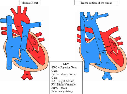 Joey's Heart Journey: Joey's Diagnoses