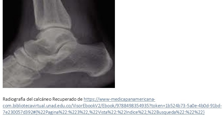 PROTOCOLOS DE LOS ESTUDIOS RADIOLÓGICOS MIEMBROS INFERIORES