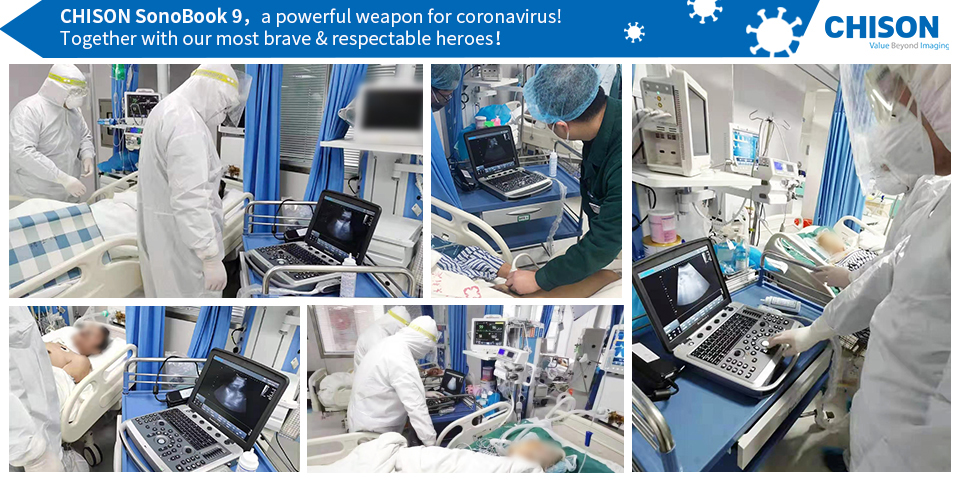 INTEGRALMED S.A. : Ecógrafo CHISON I3