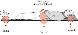 POSITION DE DÉCUBITUS DORSALE