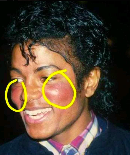The reason behind the transformation of Michael Jackson's physical ...