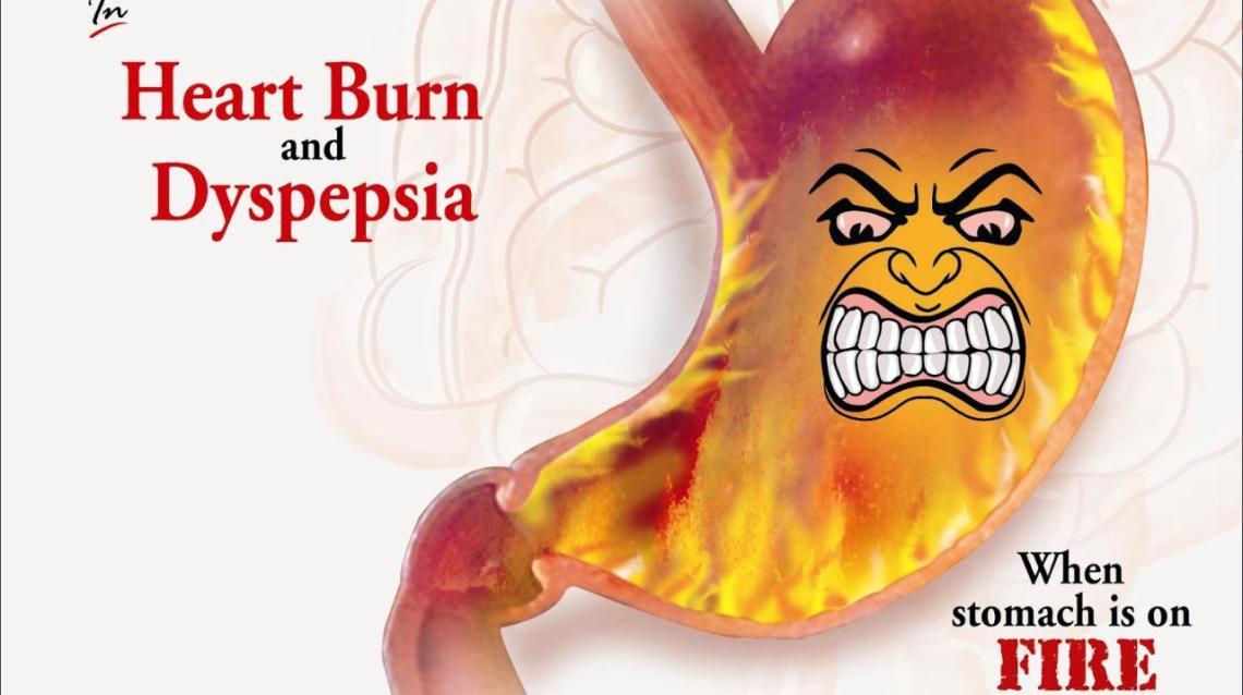 MANSI PADECHIA'S BLOG: Acidity,when the Stomach Is on Fire