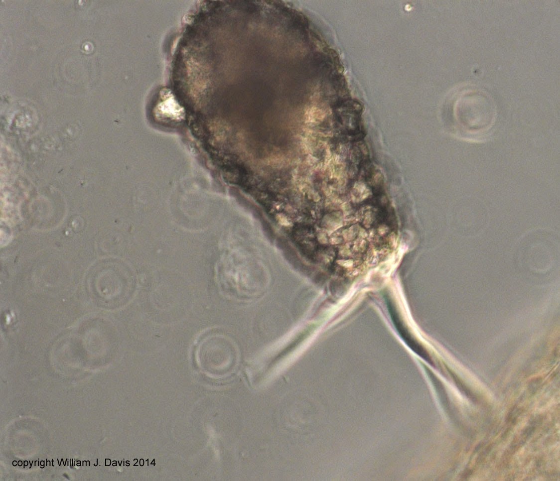 Wandering Naturalist: Protist Love 1--Difflugia!