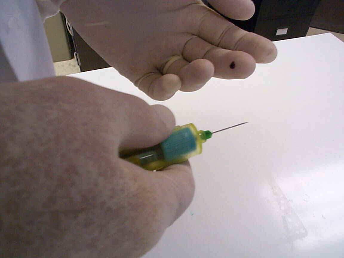 LABORATORY ACCIDENTS