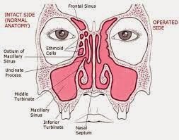 Medical Treatment Pictures-for Better Understanding: Functional ...