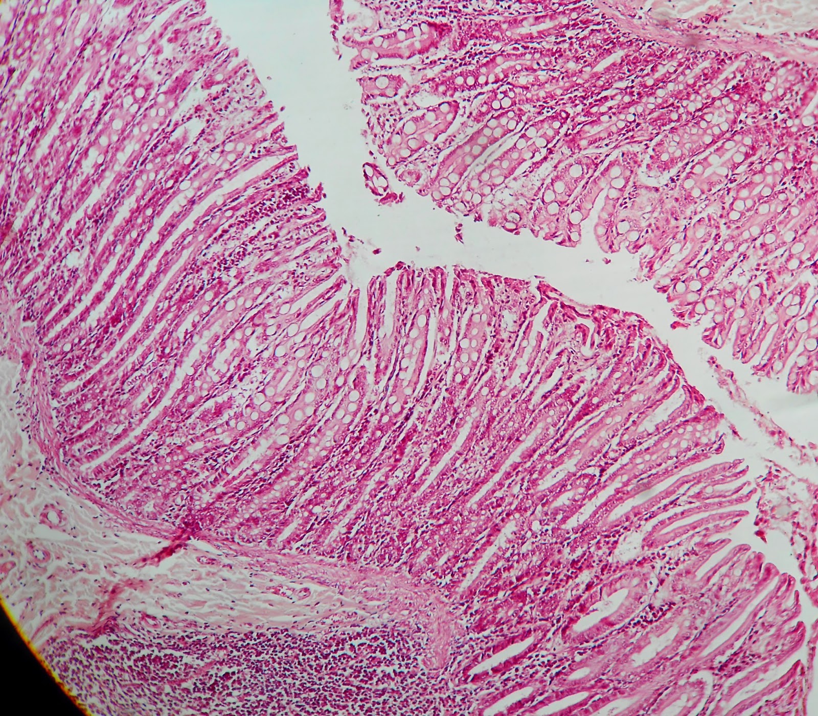 Placas Histologicas : Colon