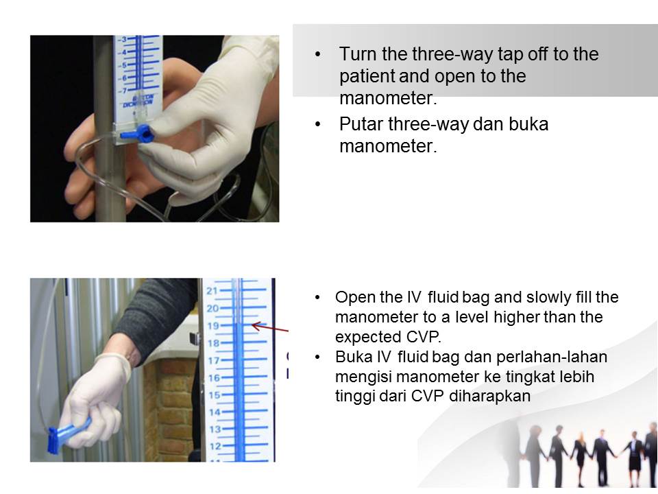 Keperawatanku: Pemasangan Central Venous Catheter (CVC) dan Pengukuran ...