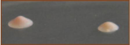 [Microbiology] Atlas of Growth Patterns on Agar | Free Medical Atlas