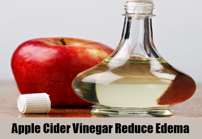 6 BEST HERBAL REMEDIES FOR EDEMA ~ Mzizi Mkavu