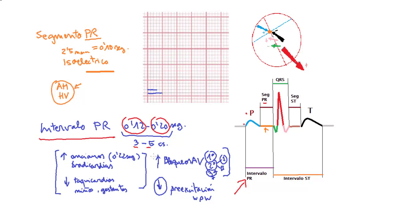 ECG normal (13): Intervalo PR (dimensiones y alteraciones) | Dr ...