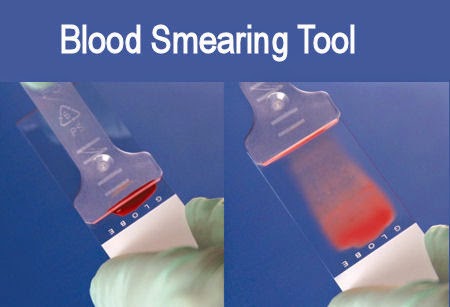Medical Laboratory and Biomedical Science: Blood Smear Tool