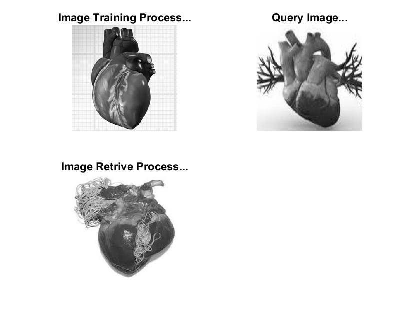 Matlab Ieee Projects 2018 Emr A Scalable Graph Based Ranking Model For Content Based Medical