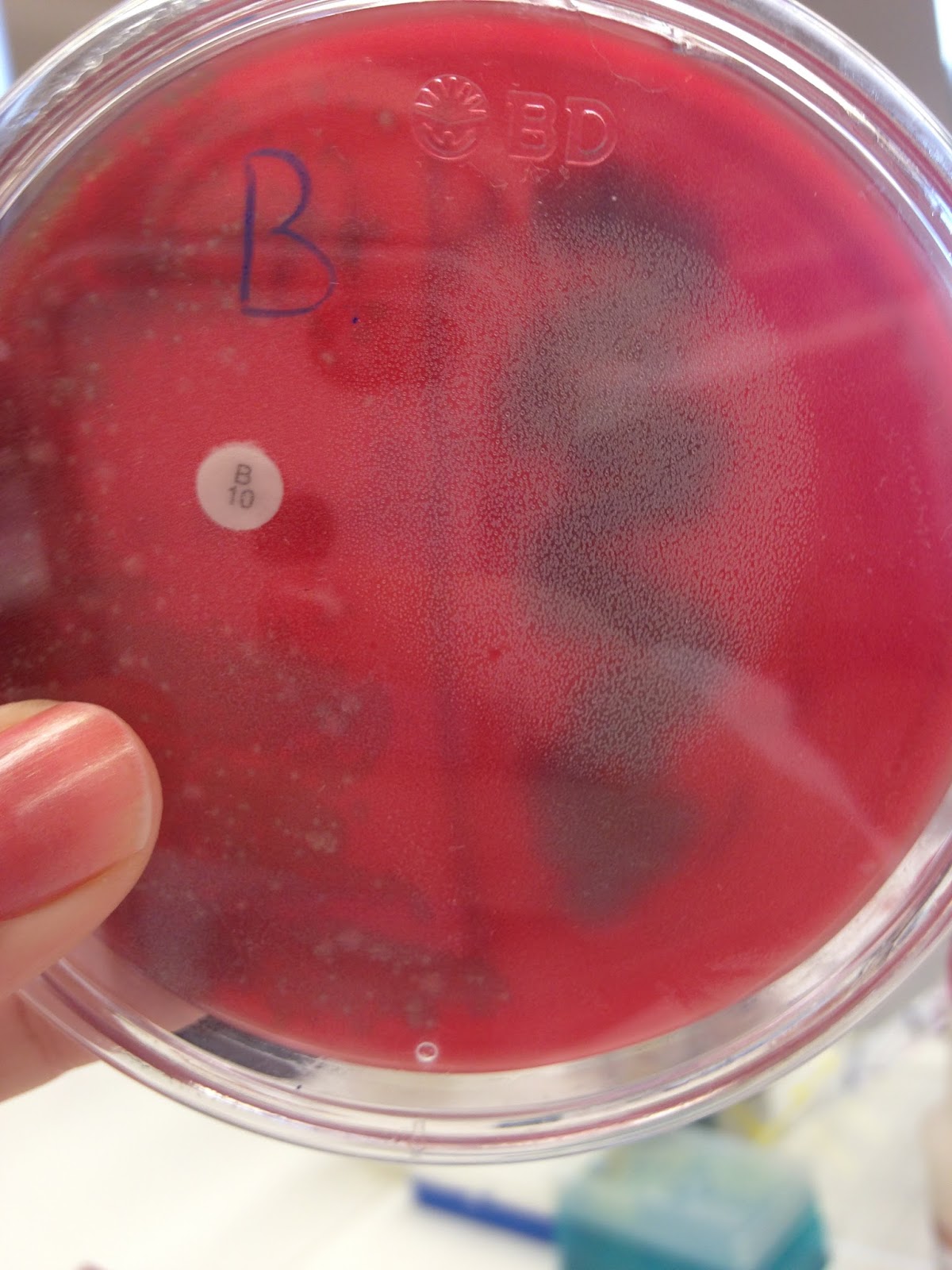 Microbiology Mania: Selective / Differential Media Inoculations and ...