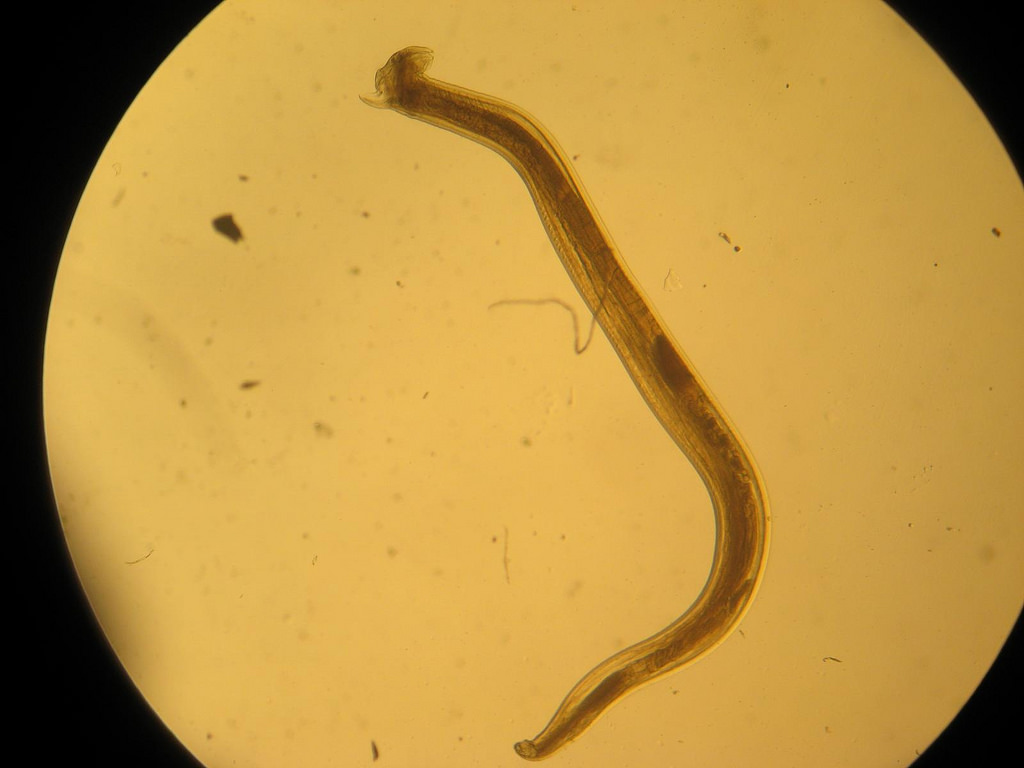 Ancylostoma duodenale - Microbiology Lab Notes
