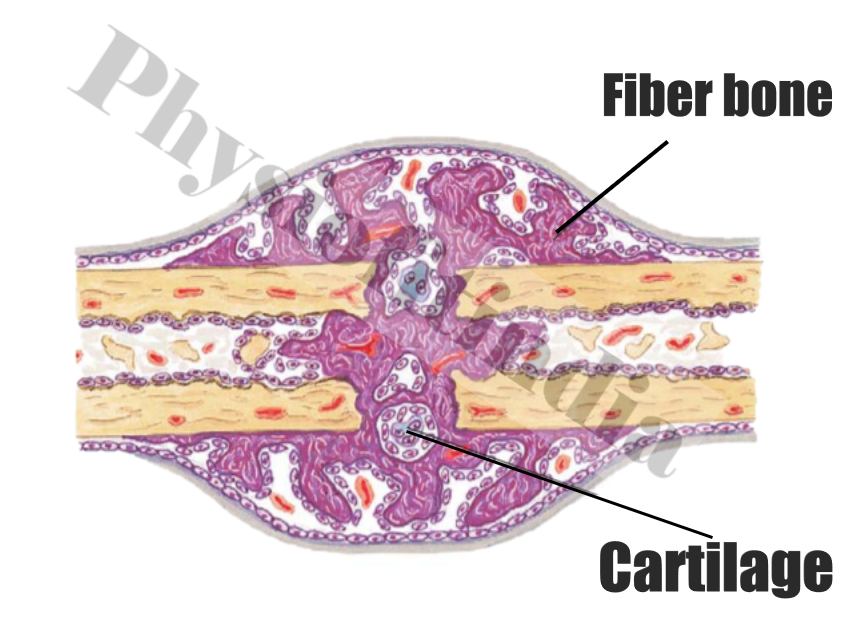 Types of Fracture,symptoms,Healing stages,Management,Physiotherapy ...