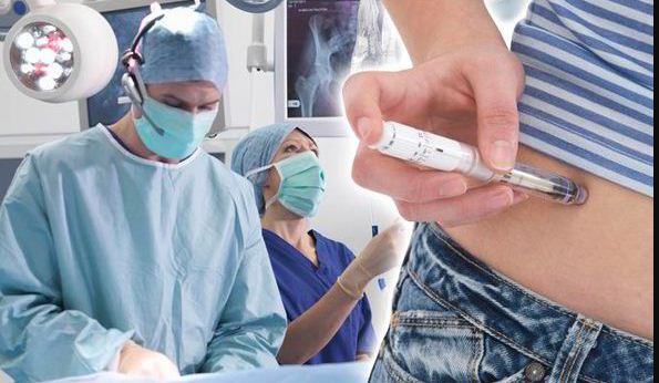 Operation Diabetes-Weight Reduction surgery for type 2 Diabetes ...