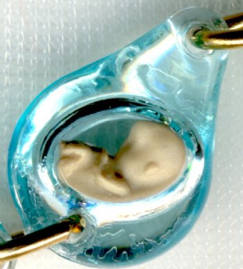 HEALING GRACE: PROMISES OF THE ROSARY OF THE UNBORN