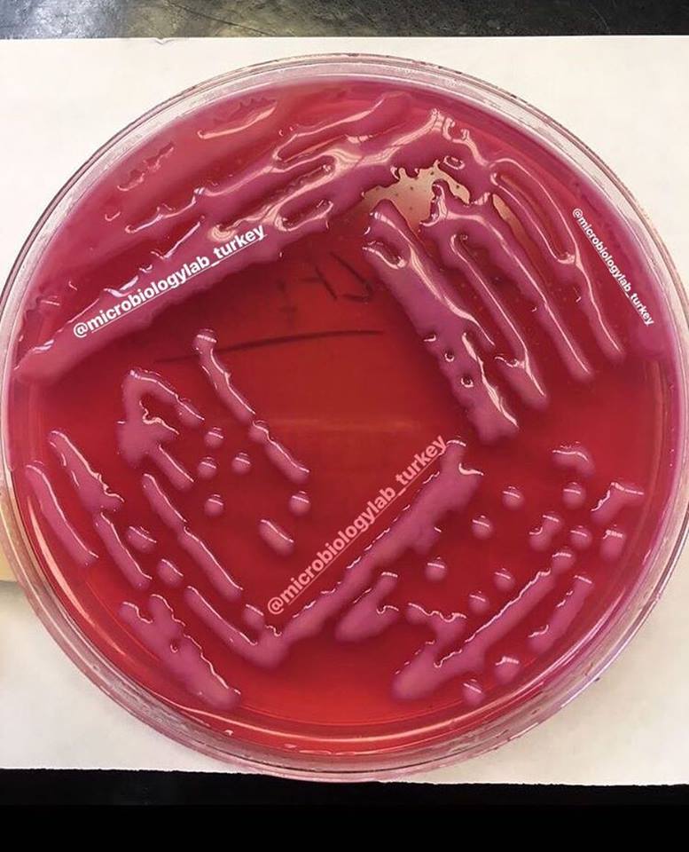 MacConkey Agar - Microbiology Laboratory Turkey