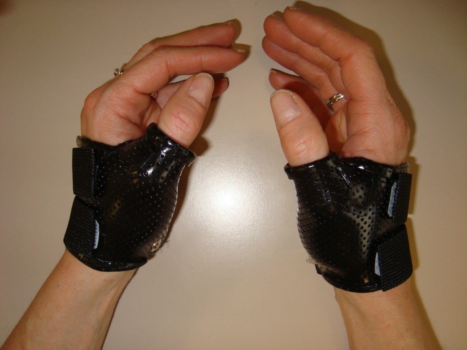 Orthèses sur mesure et appareillage personnalisé main poignet doigts ...