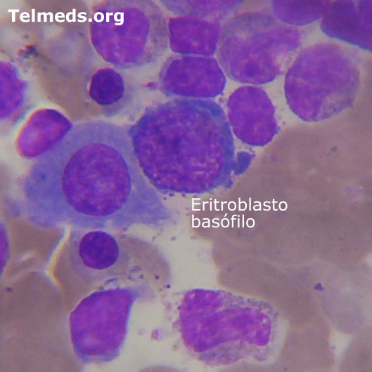 Fichero hematología: Células Sanguíneas de la Línea Roja