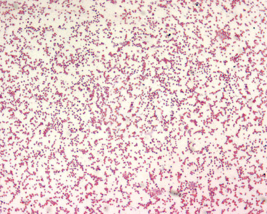 Universo Microbiológico: Francisella tularensis: tularemia