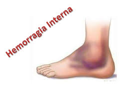 HEMORRAGIAS: HEMORRAGIAS