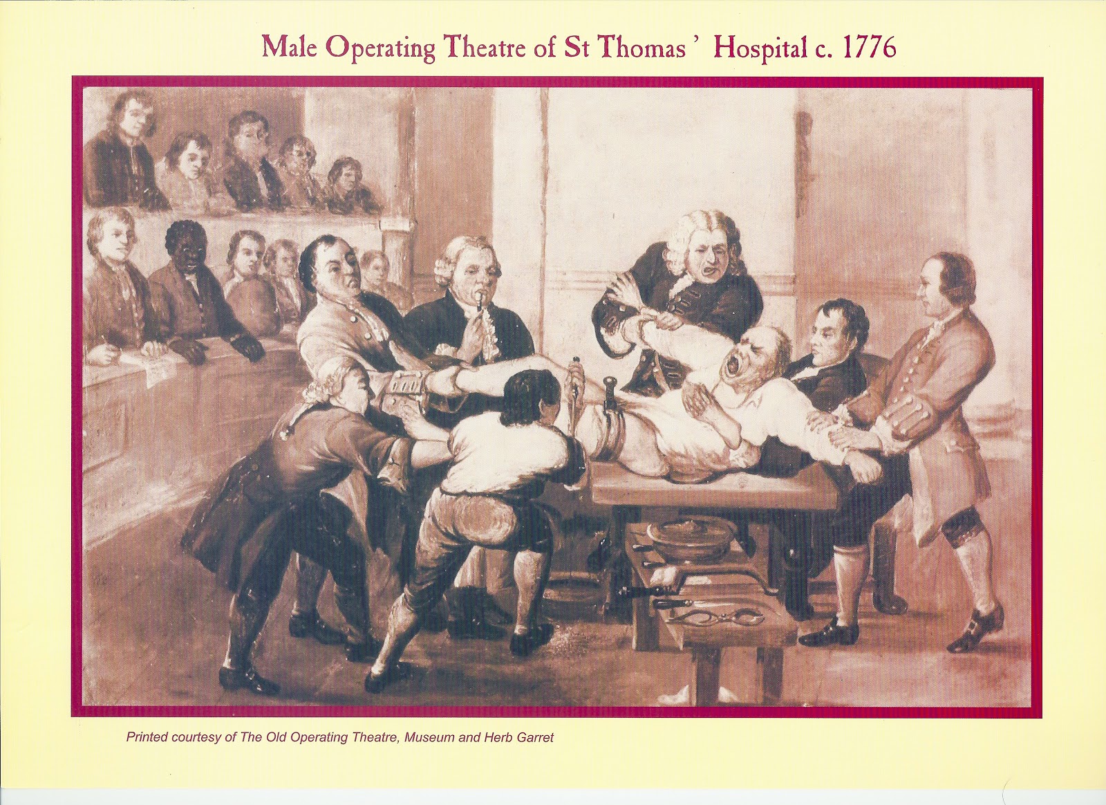 Primitive Physick: John Hunter, part 2